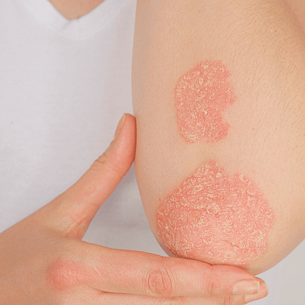 4 Facts About Peat And Why It’s Miraculously Useful For Your Skin ...